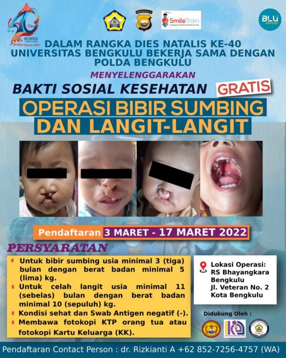 Bakti Sosial Kesehatan Operasi Bibir Sumbing dan Langit-Langit (Gratis) | UNIVERSITAS BENGKULU